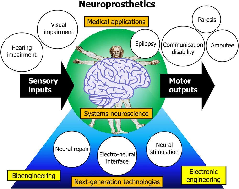 Breaking Barriers: Innovative Neuroprosthesis Aids Speech in Paralysis